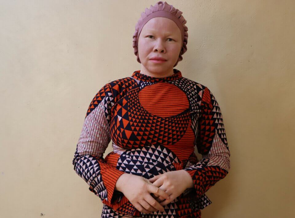 Menschen mit Albinismus haben die gleichen Rechte - Licht für die Welt